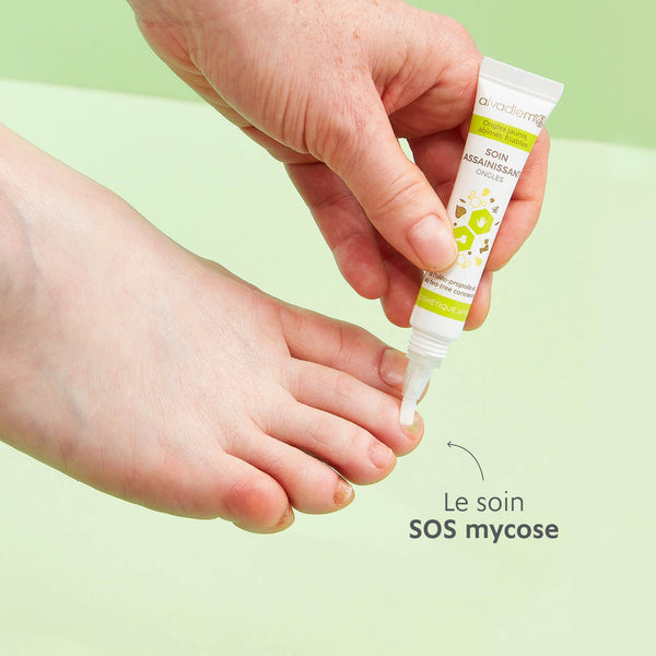 Mycose des ongles de la main : symptômes et traitements. | Alvadiem